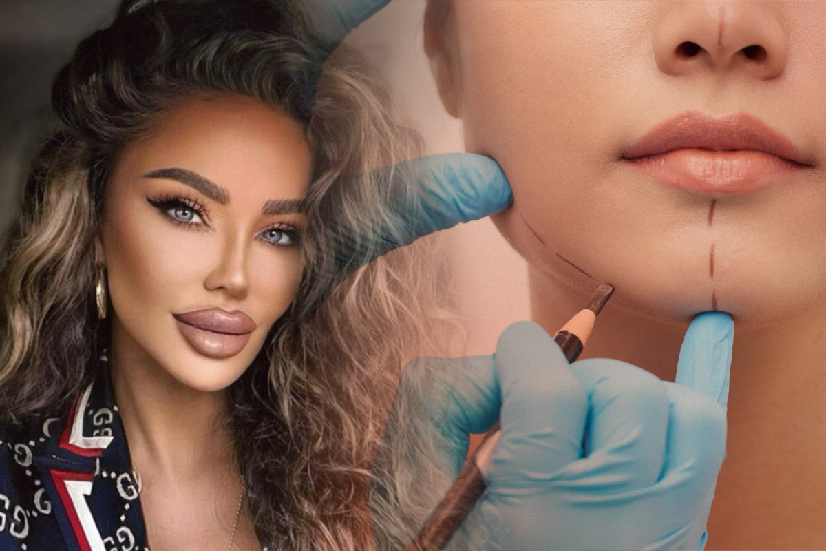 Cum Arată Bianca Drăgușanu După Ce și A Făcut O Nouă Procedură Estetică La Față Vedeta Nu S A